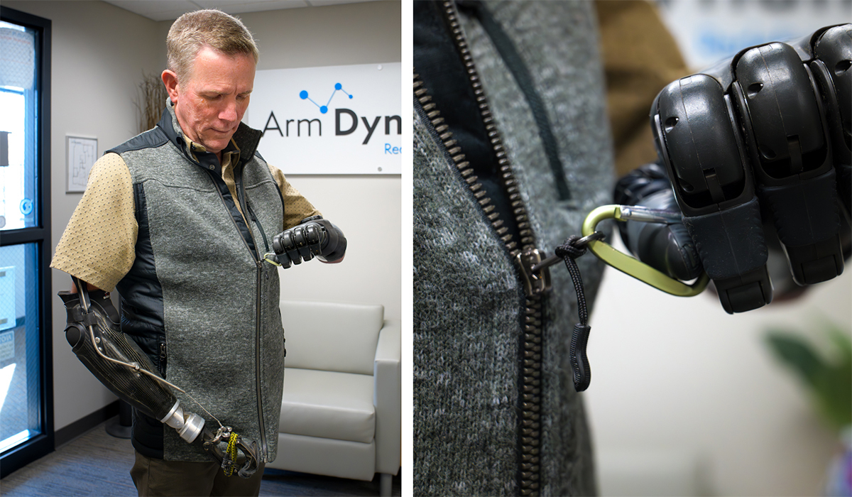 The Upper Limb Library